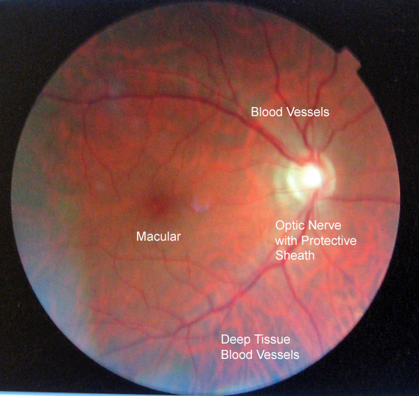 The Lidless Eye | RegenAxe